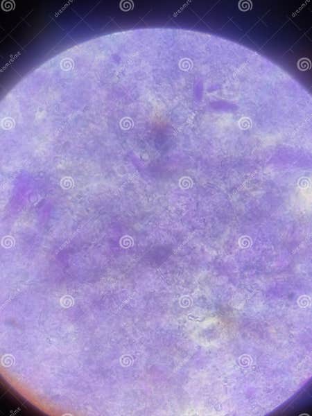 The Brain of a Pig Under the Microscope Stock Image - Image of view ...