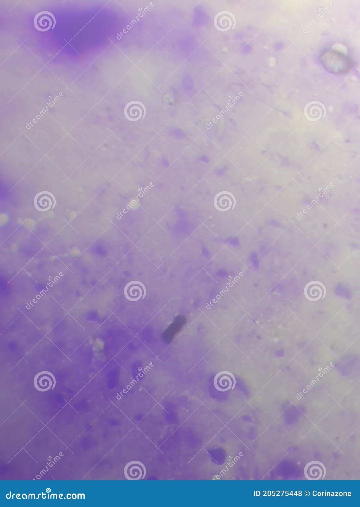 The Brain of a Pig Under the Microscope Stock Photo - Image of cerebral ...