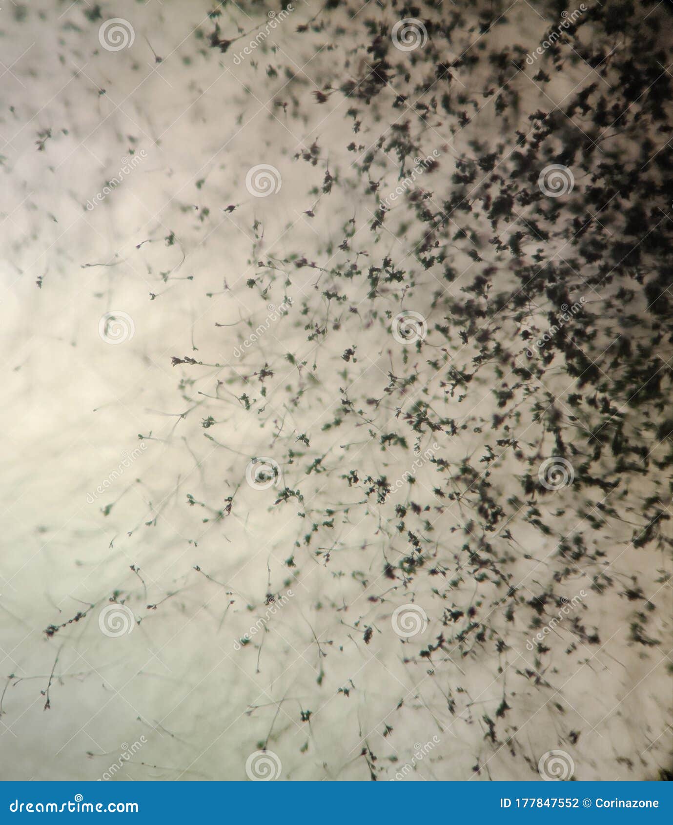 Aspergillus Fumigatus Under the Microscope Stock Photo - Image of ...