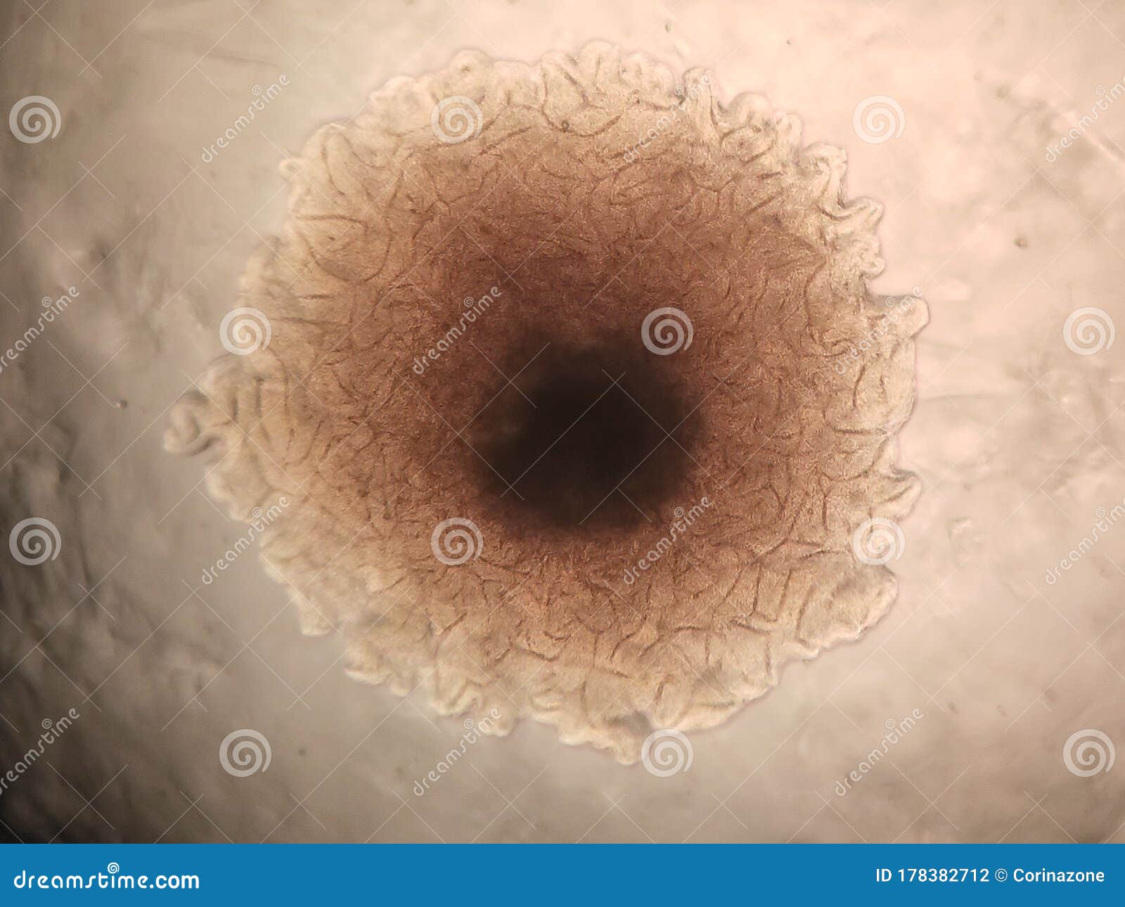 Bacillus Subtilis Beautiful Bacterial Growth Under The Microscope Stock ...