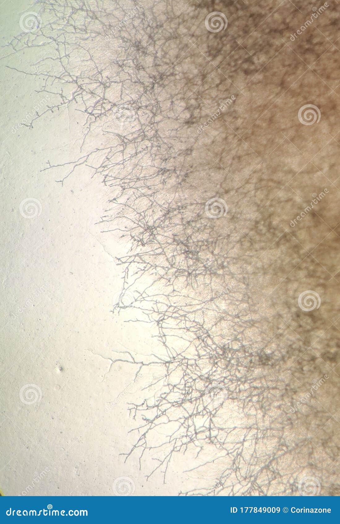Dermatphyte Fungus Under the Microscope Stock Image - Image of ...