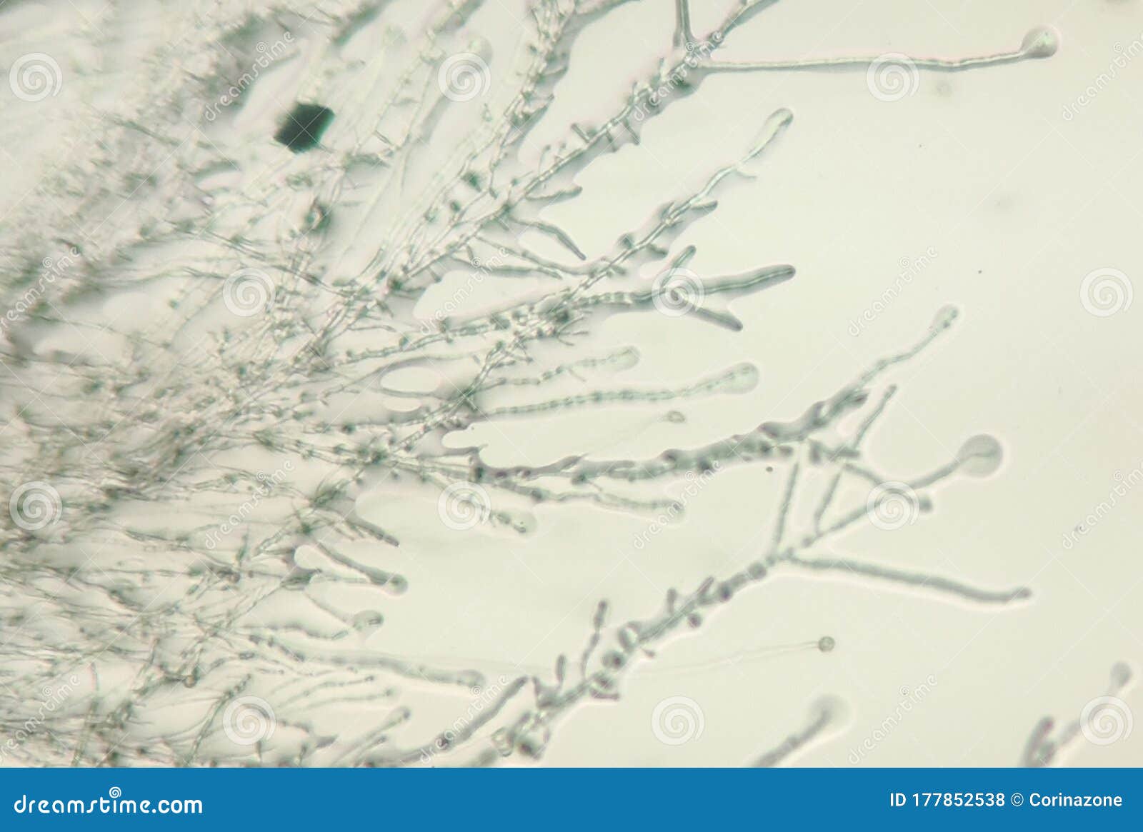 Dermatphyte Fungus Under the Microscope Stock Photo - Image of fungus ...