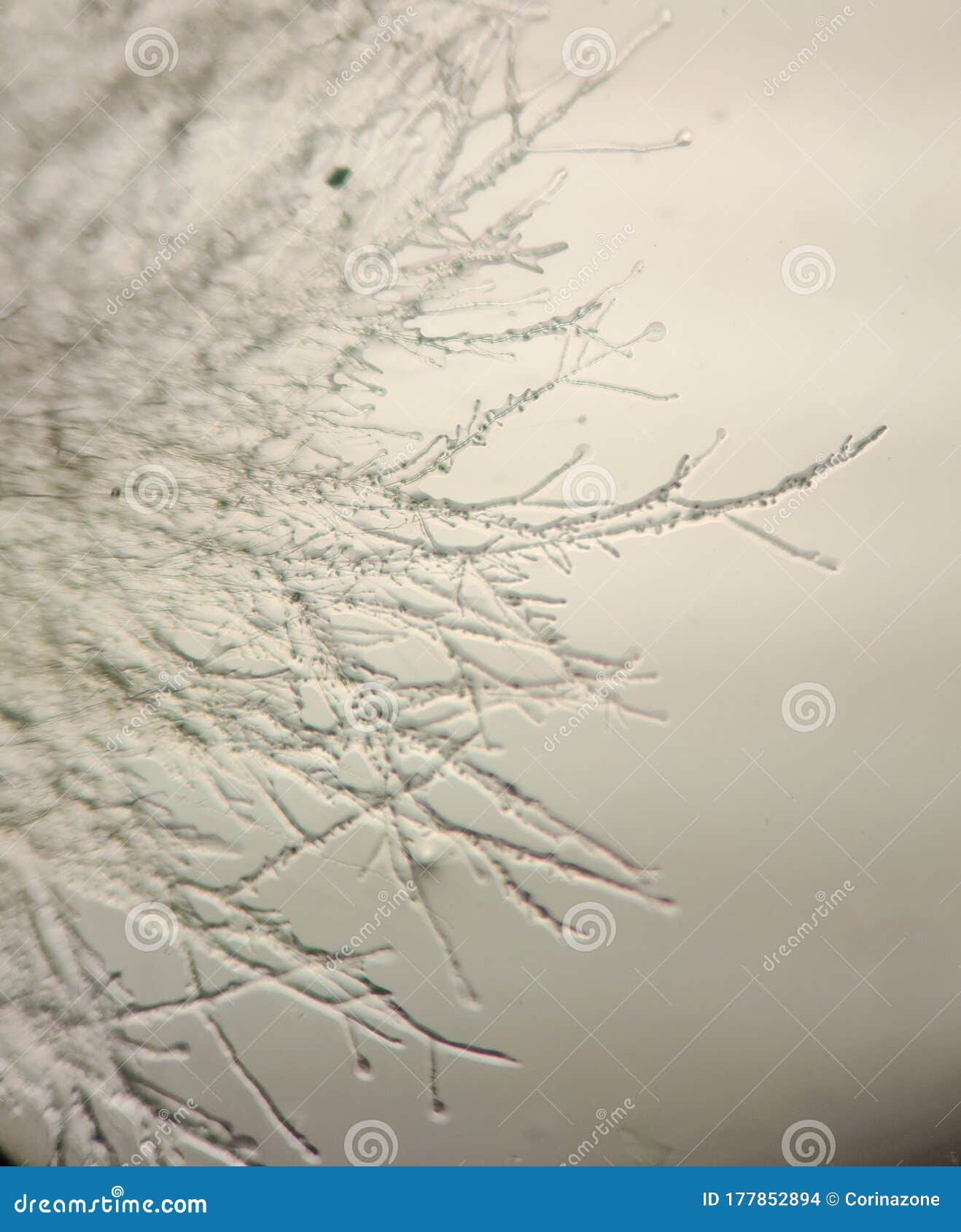 Dermatophyte Fungus Isolated From Human Skin Under The Microscope ...