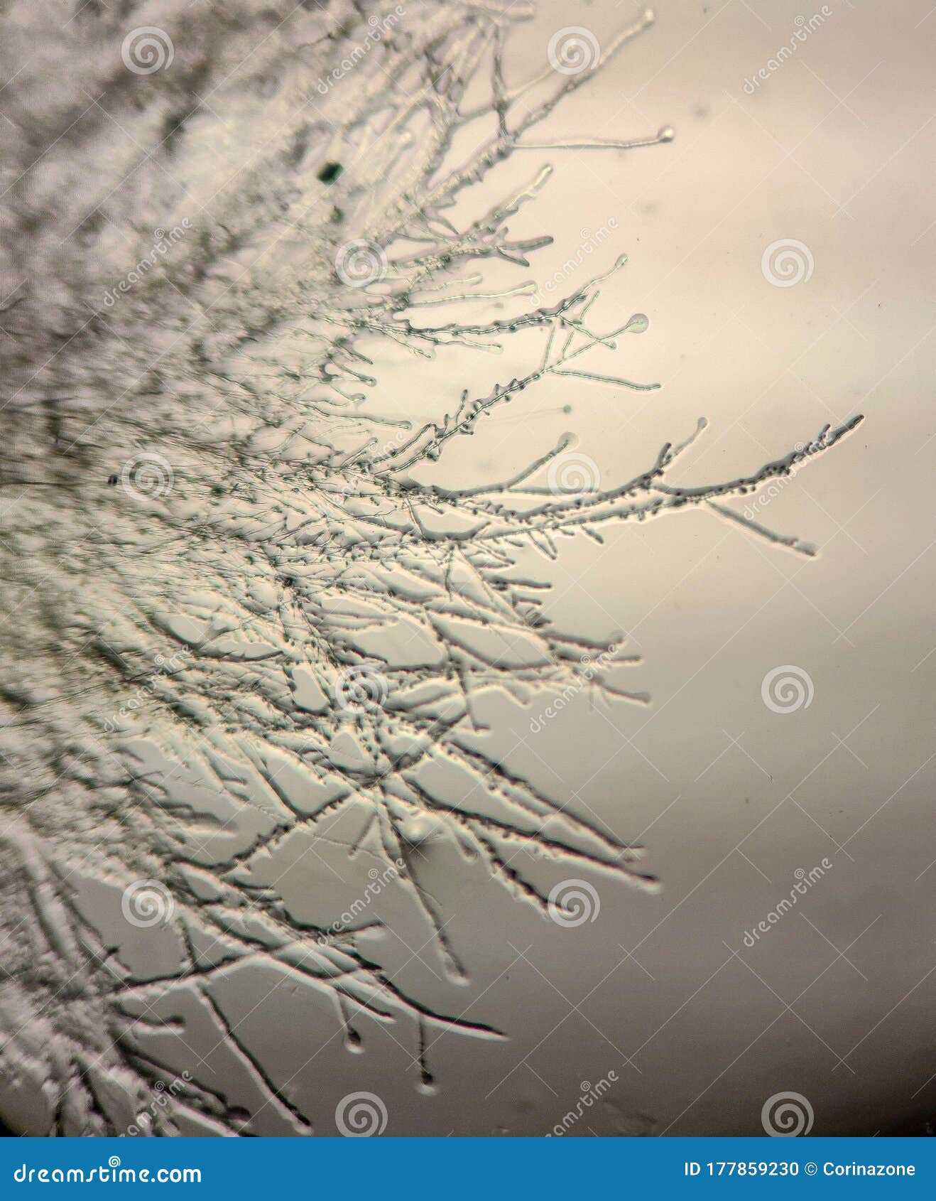 Dermatophyte Fungus Under the Microscope Stock Photo - Image of fractal ...
