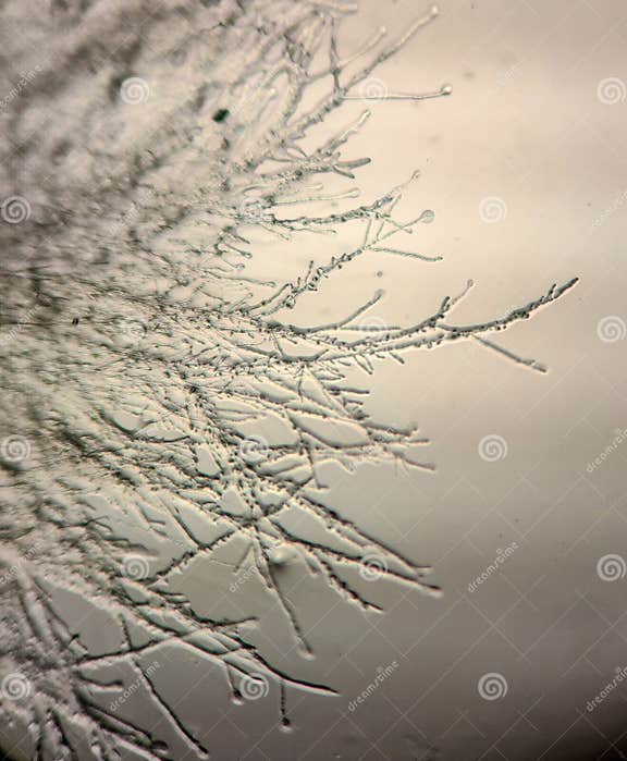 Dermatophyte Fungus Under the Microscope Stock Photo - Image of fractal ...