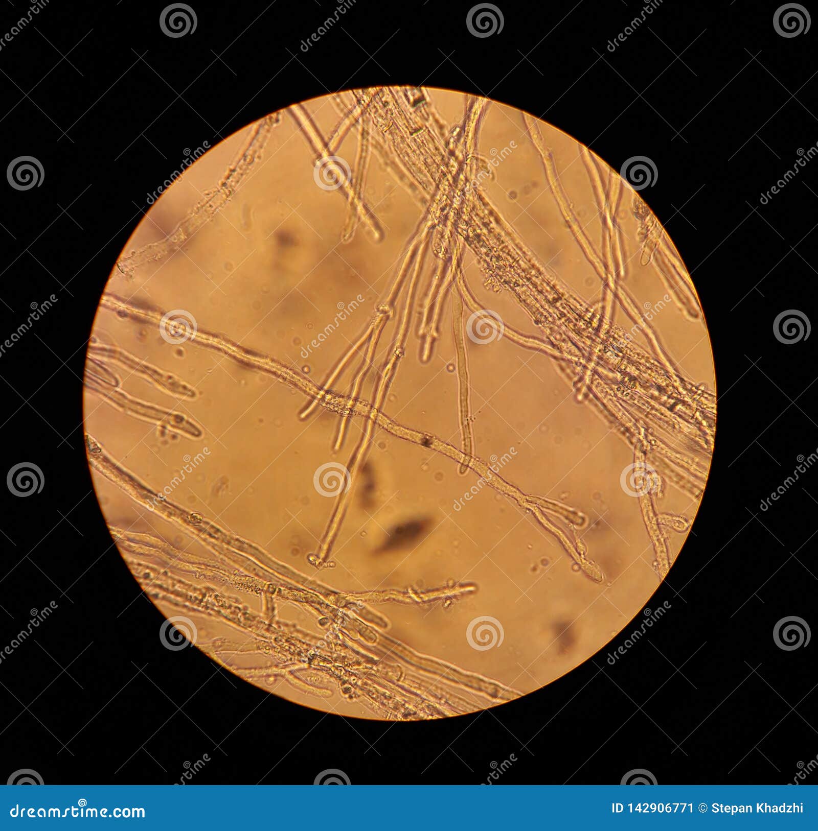 Microscope View of Fungi Mycelium Filaments 40x Increase Stock Image ...