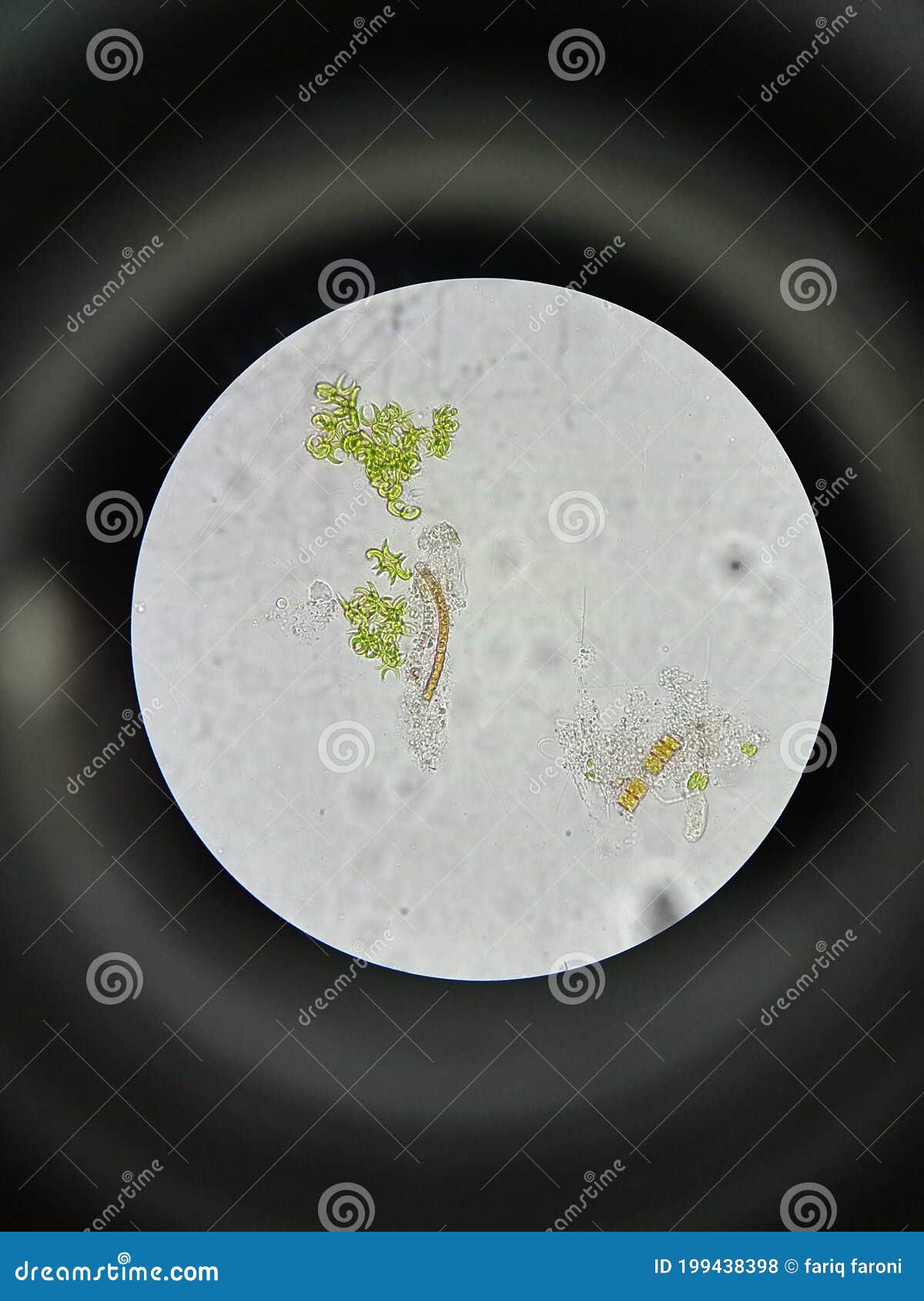 Leaf Cells Under Microscope. Micrograph, Leaf Under A Microscope, Organ ...