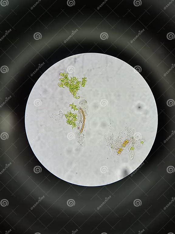 A Microscope View of Leaf Cells Stock Photo - Image of cells, flower ...