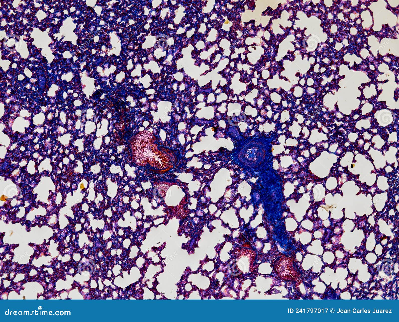 Microscope View of 10 Micron Cross Section of a Lung Tissue - Light ...