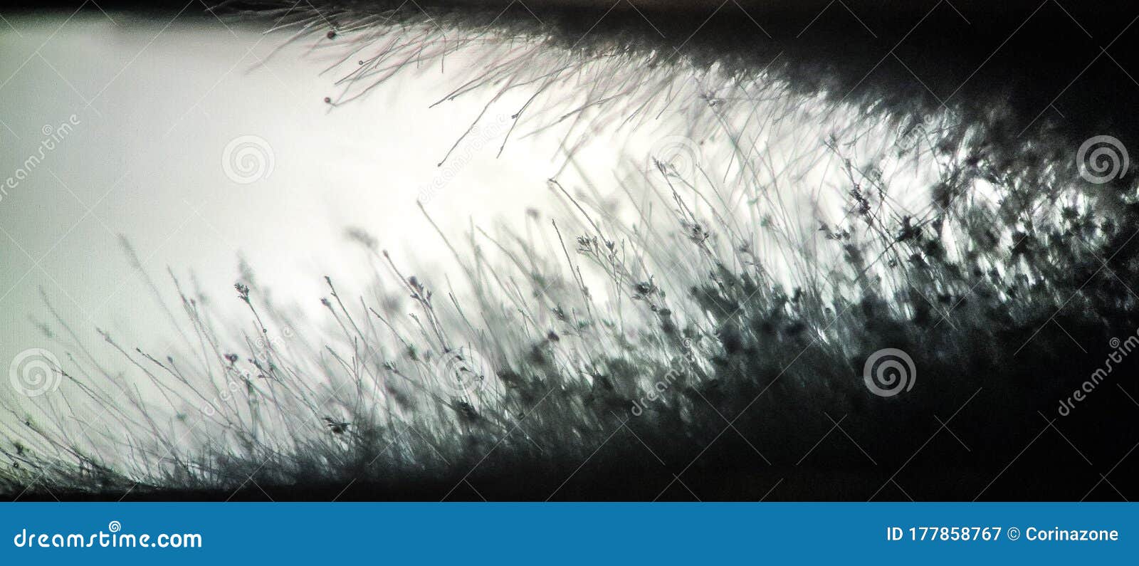 Aspergillus Fumigatus, Microscope View of the Mycelium Stock Image ...