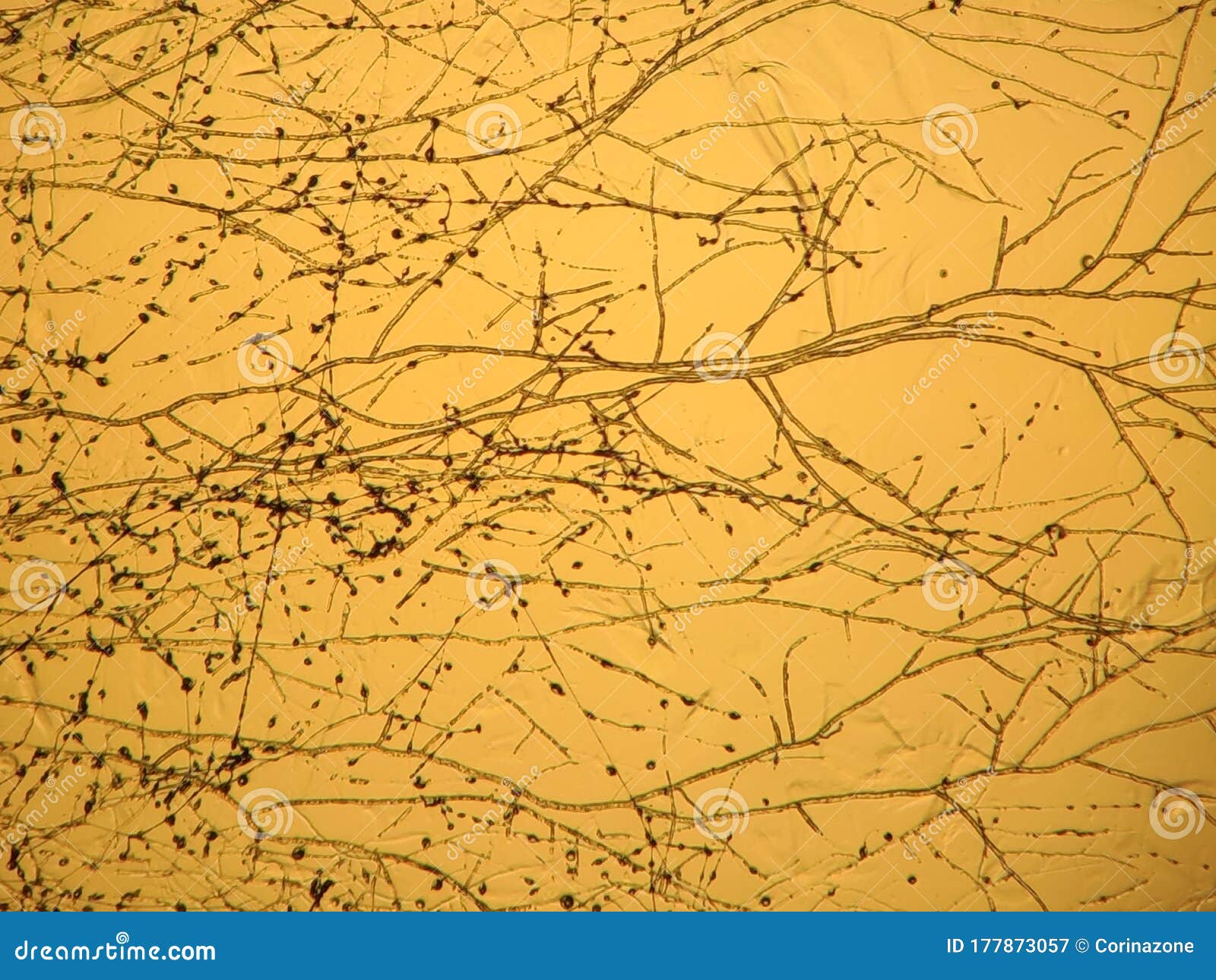 Dermatophyte Fungus Under the Microscope Stock Image - Image of ...