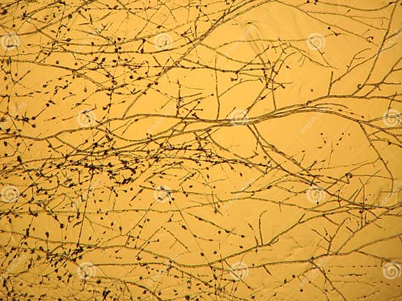 Dermatophyte Fungus Under the Microscope Stock Image - Image of ...