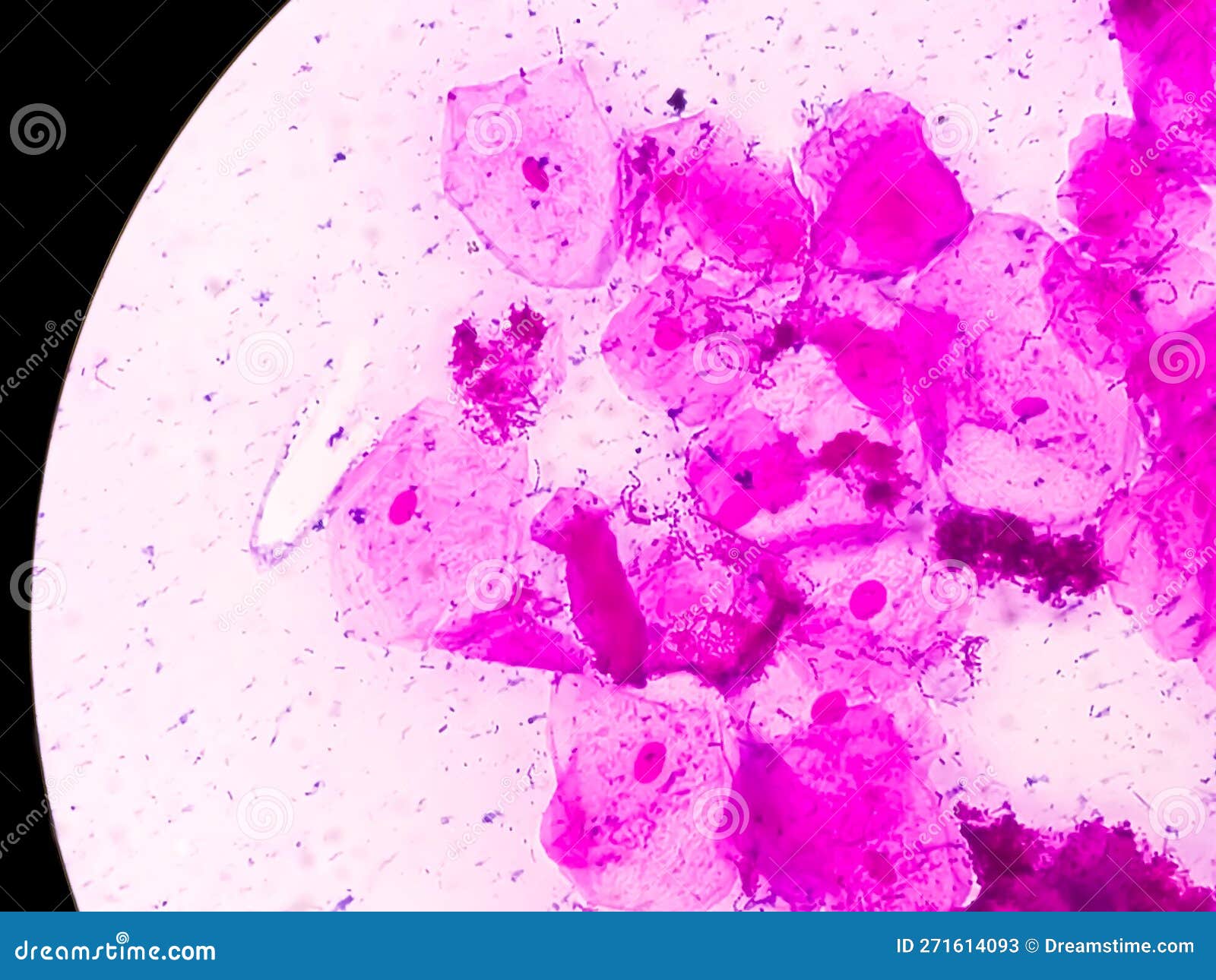 Microscopic Close View Of High Vaginal Swab Bacterial Vaginosis Bv