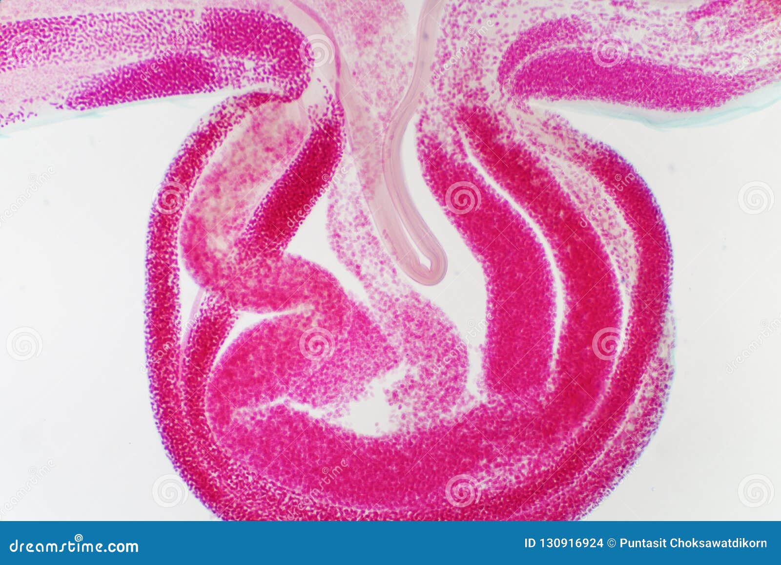 Microscopic Image Of The Eggs Parasite Toxocara Canis Under T Stock ...