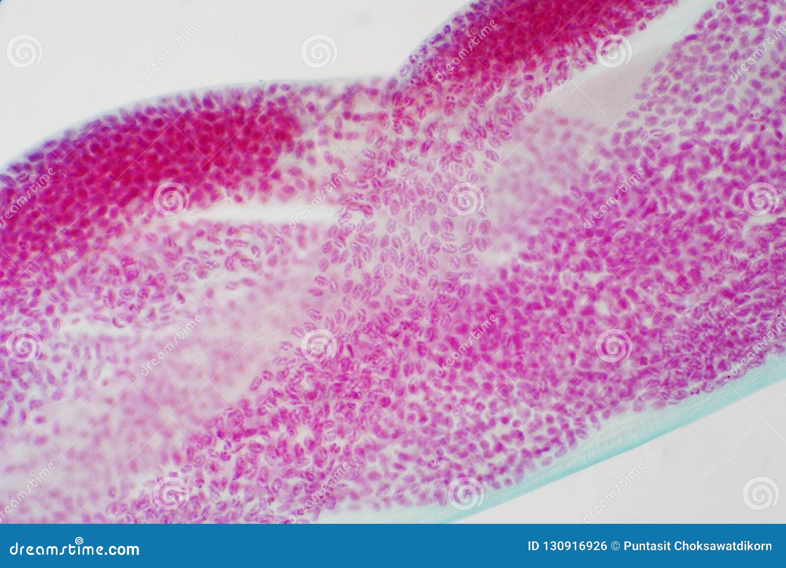 Two Eggs Of Toxocara Cati And Two Oocysts Of Isospora Felis Under The ...