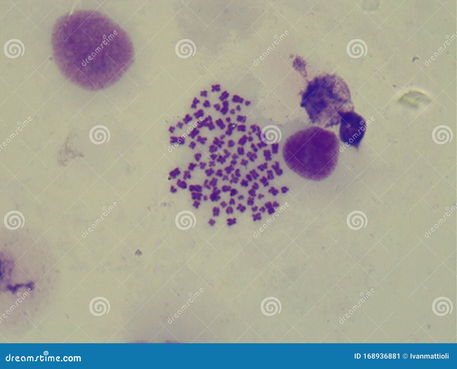 Microscopic Image of Human Chromosomes 1000x Stock Image - Image of ...