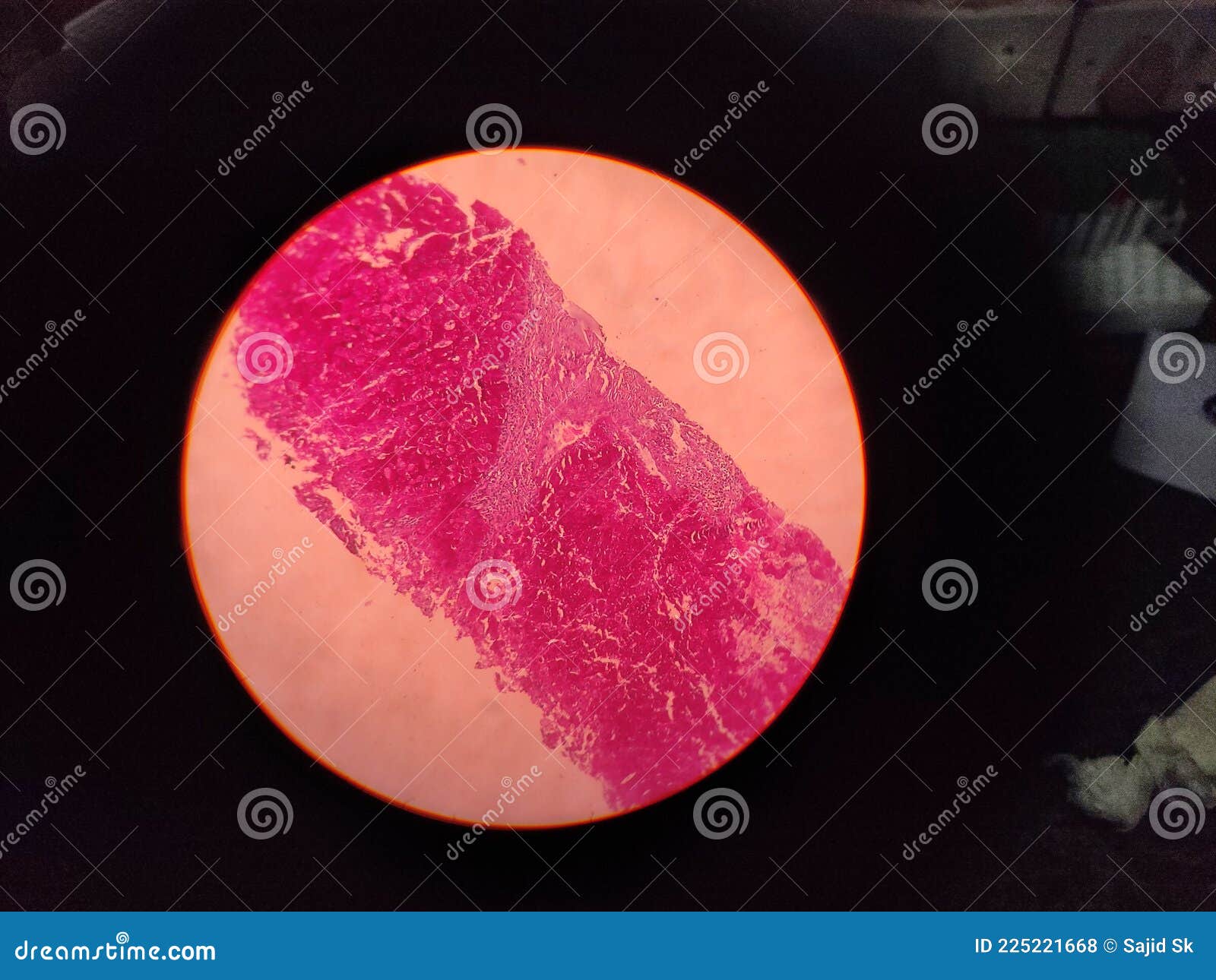Histology Slide Of Placenta Stained For GAGs Royalty-Free Stock Image ...
