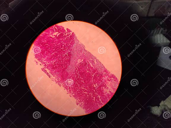 Microscopic Image of a Human Tissue Stain Slide. Histology Stain Stock ...