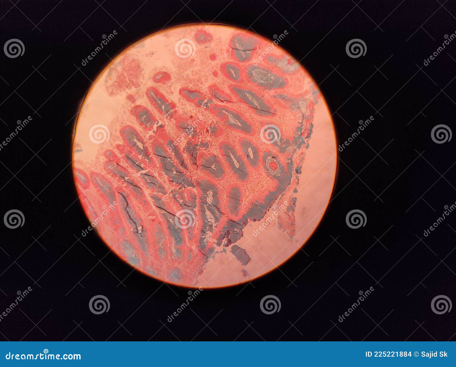Microscopic Image of a Human Tissue Stain Slide. Histology Stain Stock ...