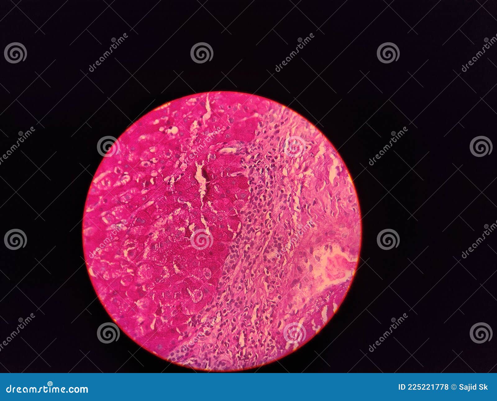 Microscopic Image of a Human Tissue Stain Slide. Histology Stain Stock ...