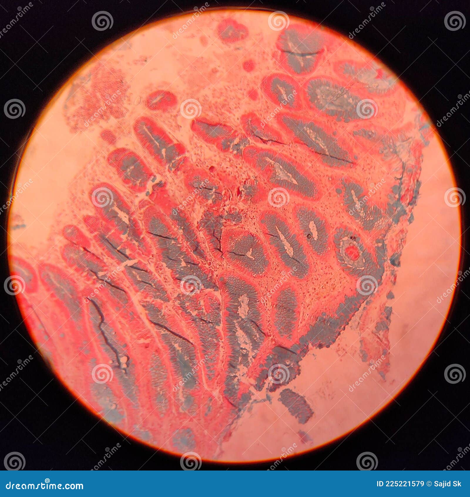 Microscopic Image of a Human Tissue Stain Slide. Histology Stain Stock ...