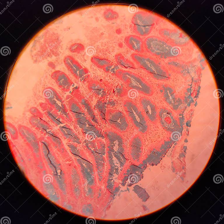 Microscopic Image of a Human Tissue Stain Slide. Histology Stain Stock ...