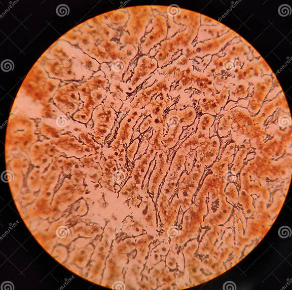 Microscopic Image of a Human Tissue Stain Slide. Histology Stain Stock ...