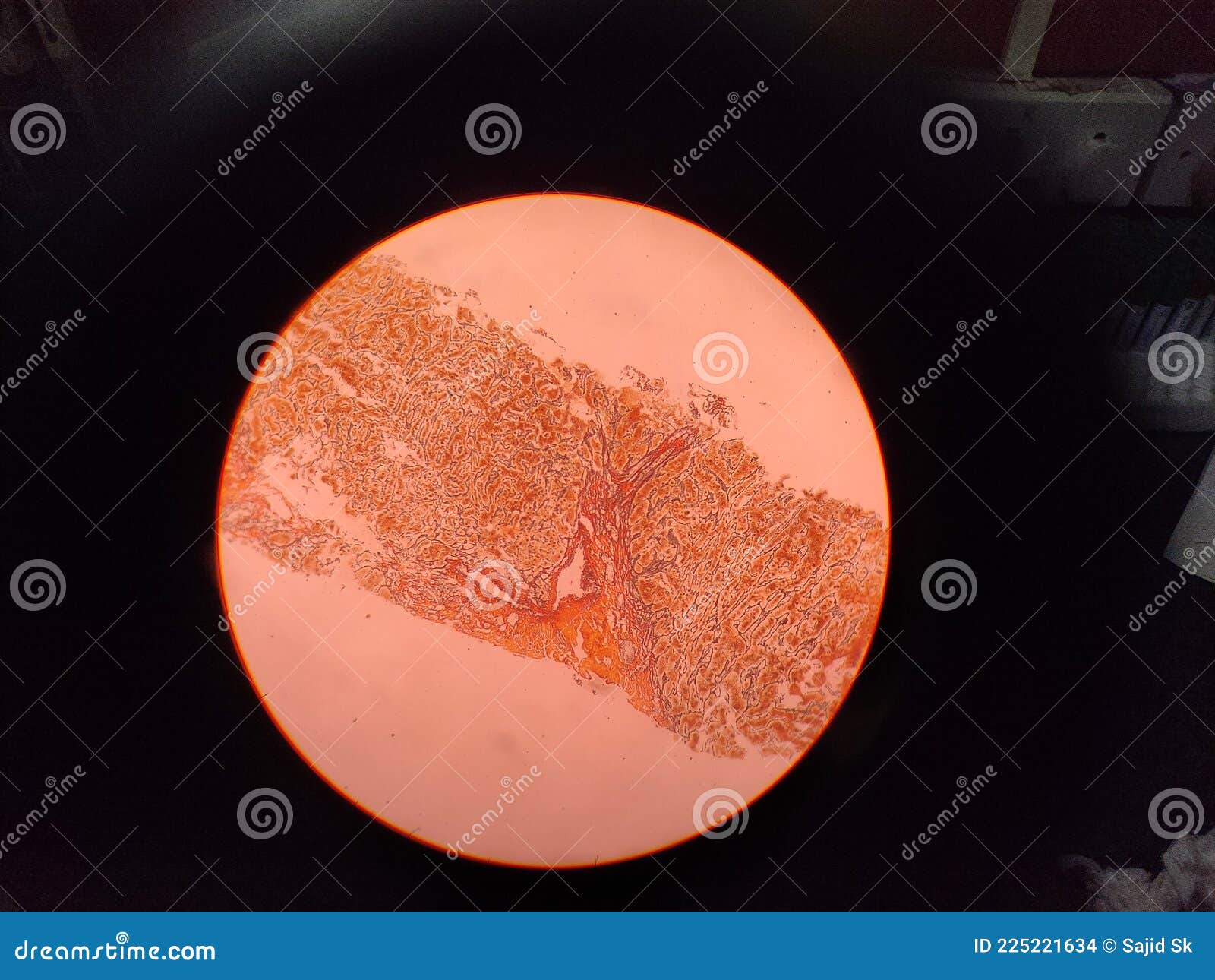 Microscopic Image of a Human Tissue Stain Slide. Histology Stain Stock ...