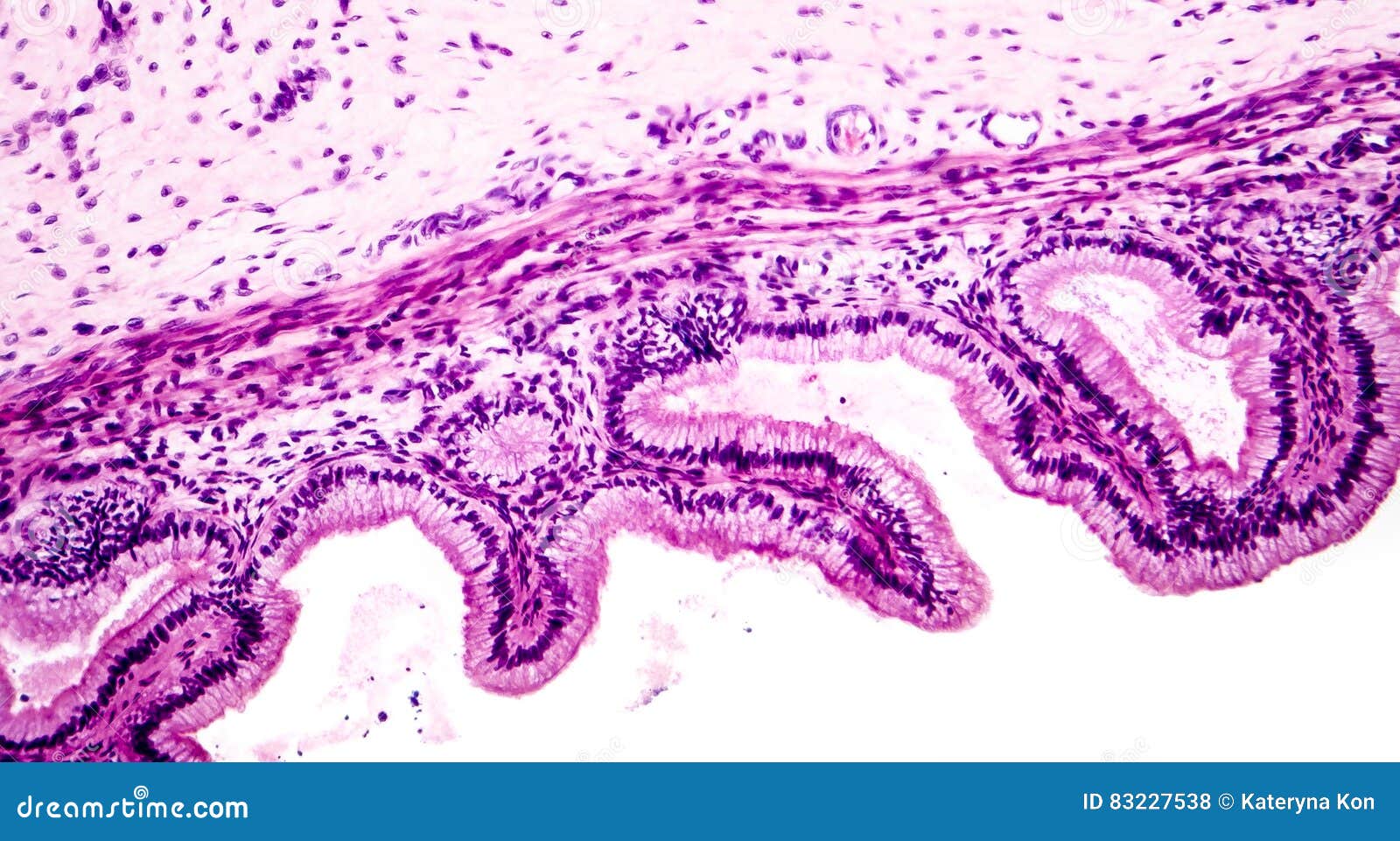 Microscopic Image Showing Epithelium of Urinary Bladder Stock Photo ...