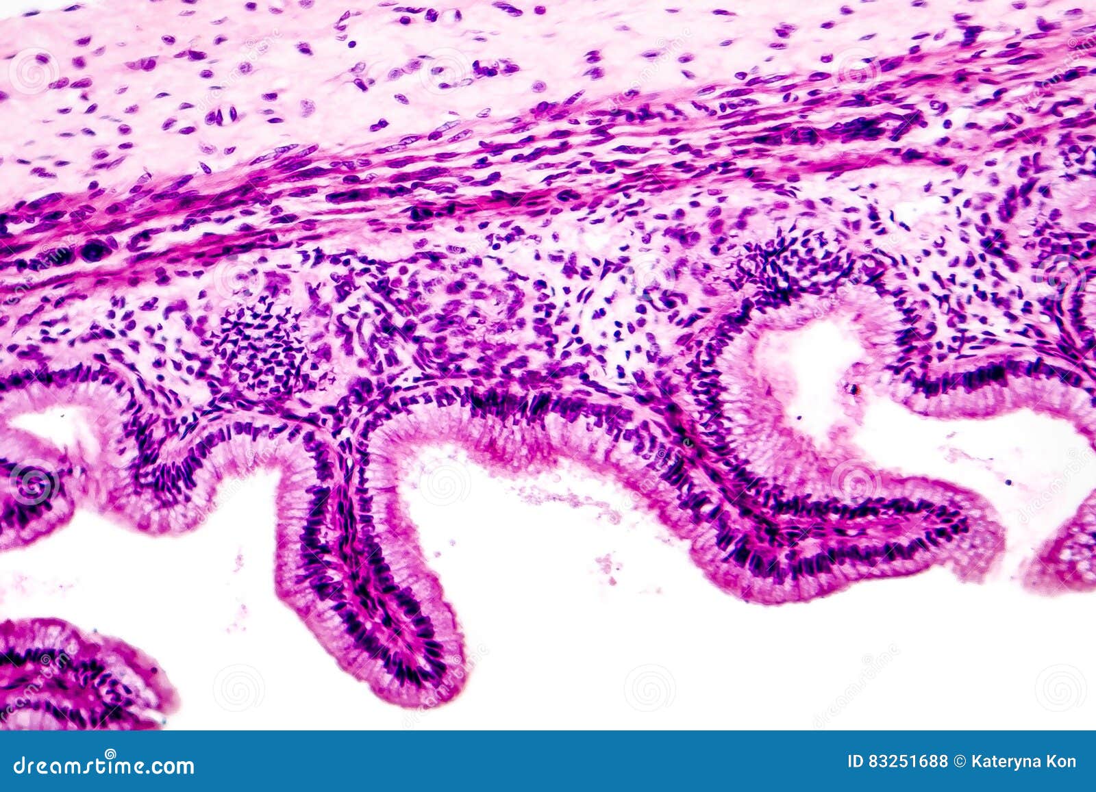 Microscopic Image Showing Epithelium of Urinary Bladder Stock Photo ...