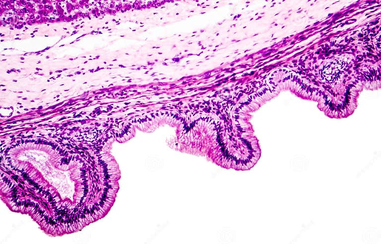 Microscopic Image Showing Epithelium of Urinary Bladder Stock Image ...