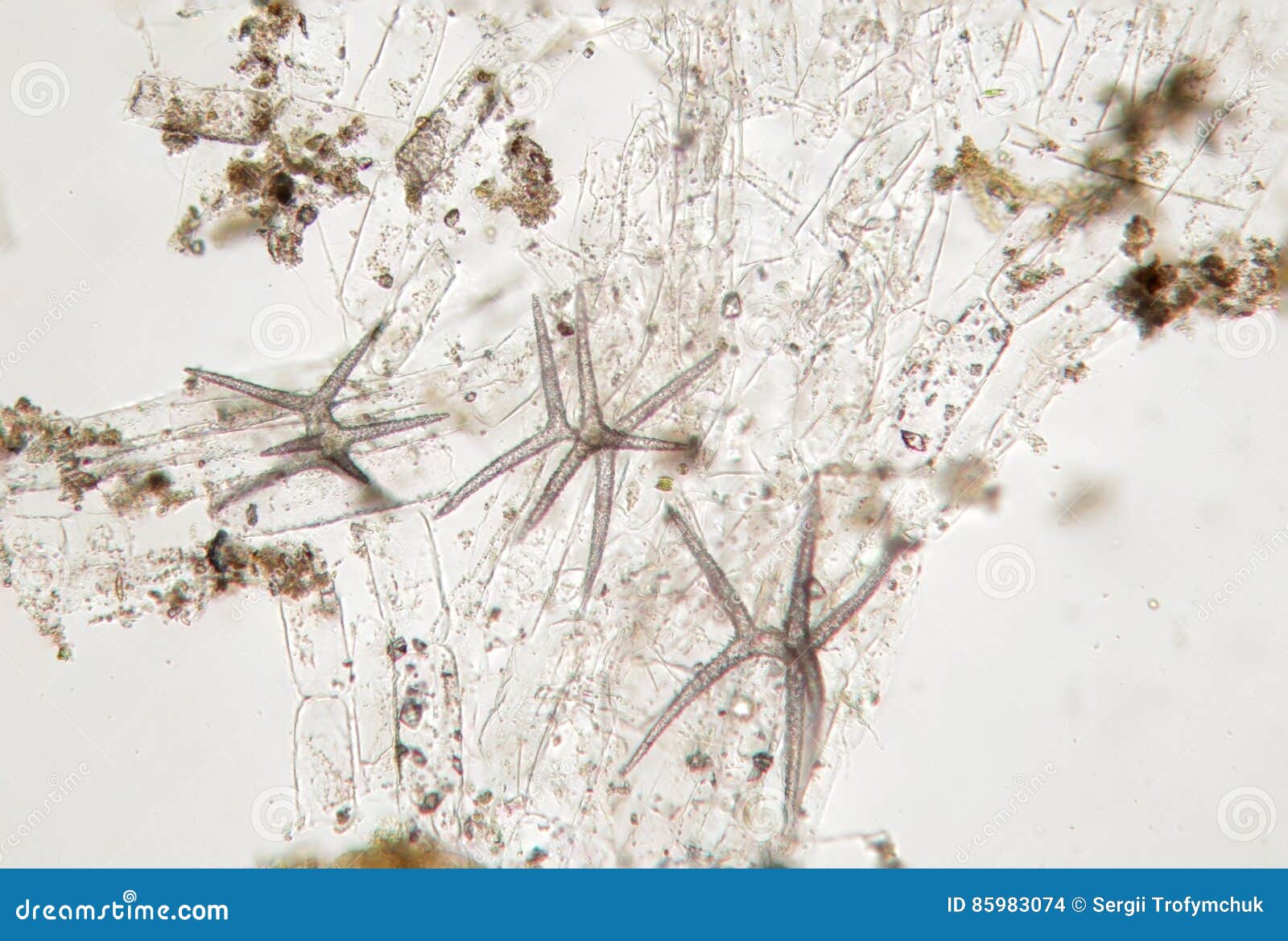 Freshwater Phytoplankton Round Diatom Algae Stephanodiscus By ...