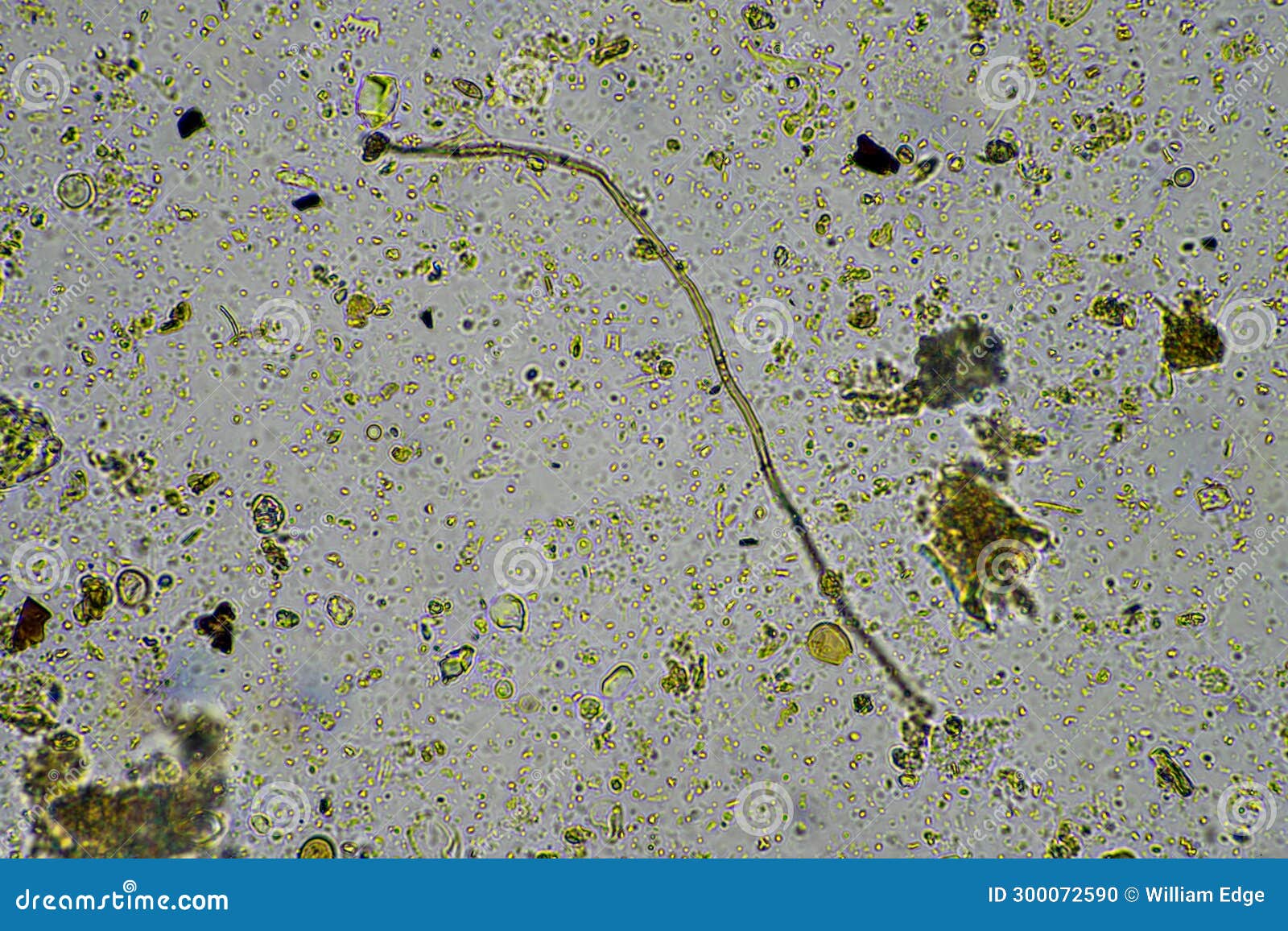 Microscopic Microorganisms Under the Microscope in a Soil Sample Stock ...