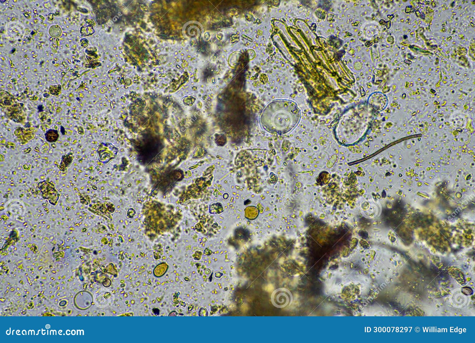 Microorganisms Under A Microscope For Fuel Cell Research Royalty-Free ...