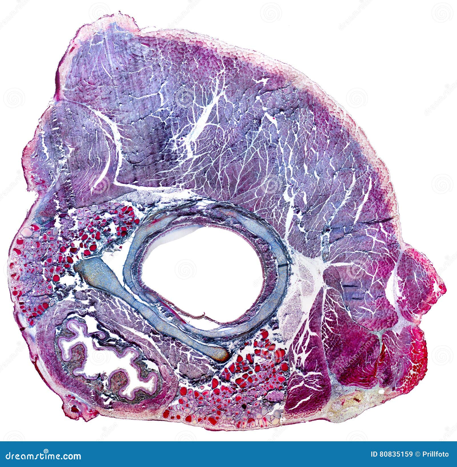 Microscopic neck organs stock image. Image of micrograph - 80835159