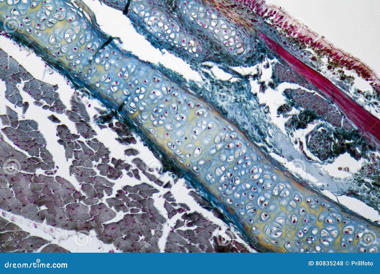 Microscopic neck organs stock photo. Image of medicine - 80835248