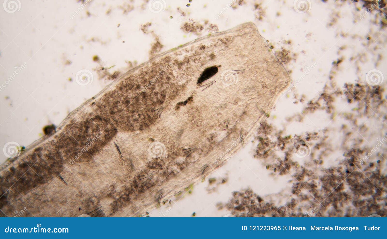 Microscopic Organisms from the Pond Water. Nematode Stock Image - Image ...