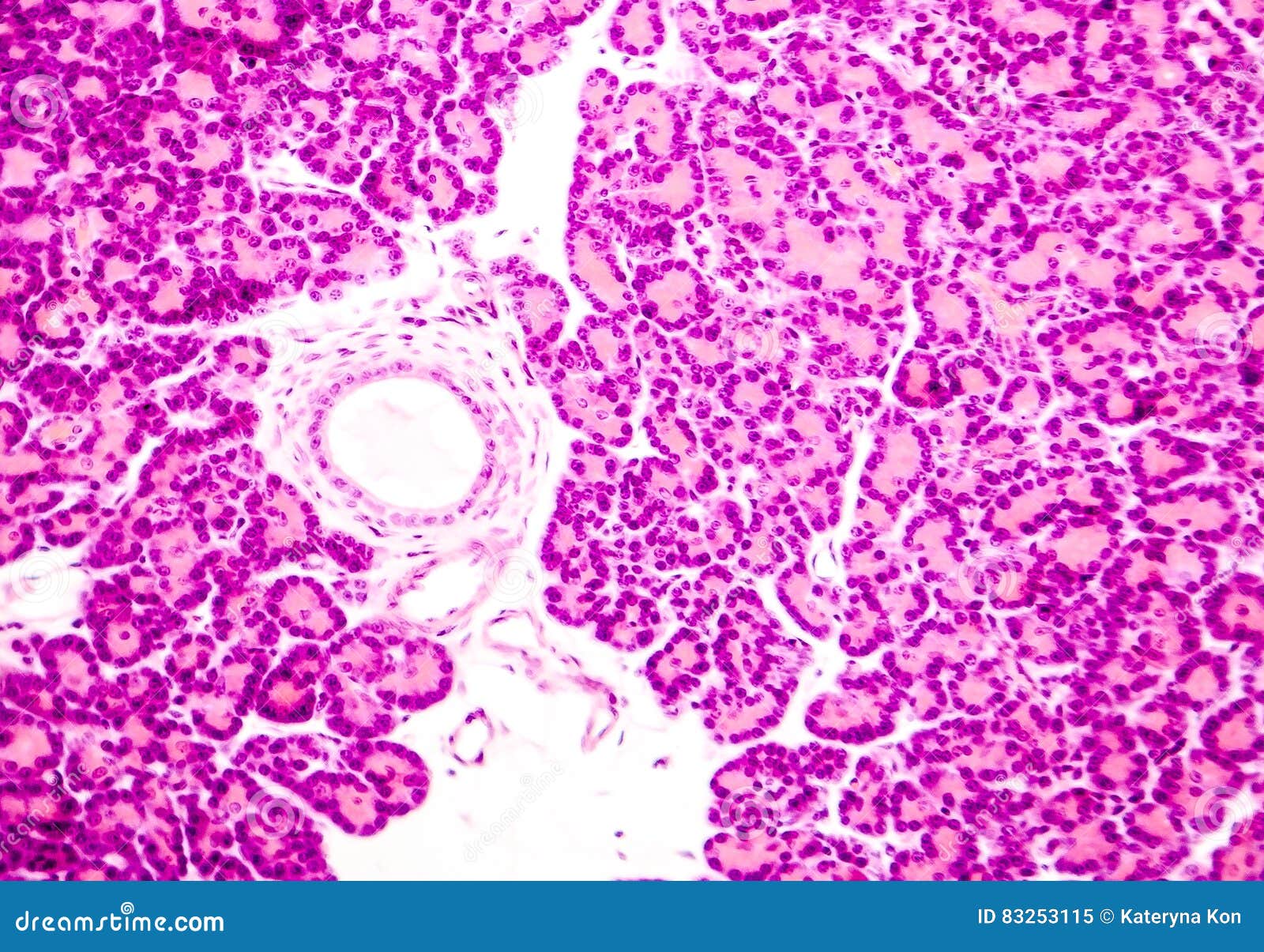 Microscopic Photo Showing Pancreatic Tissue Stock Image - Image of ...