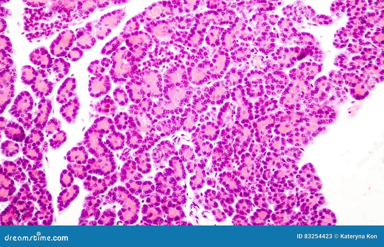 Microscopic Photo Showing Pancreatic Tissue Stock Image - Image of ...