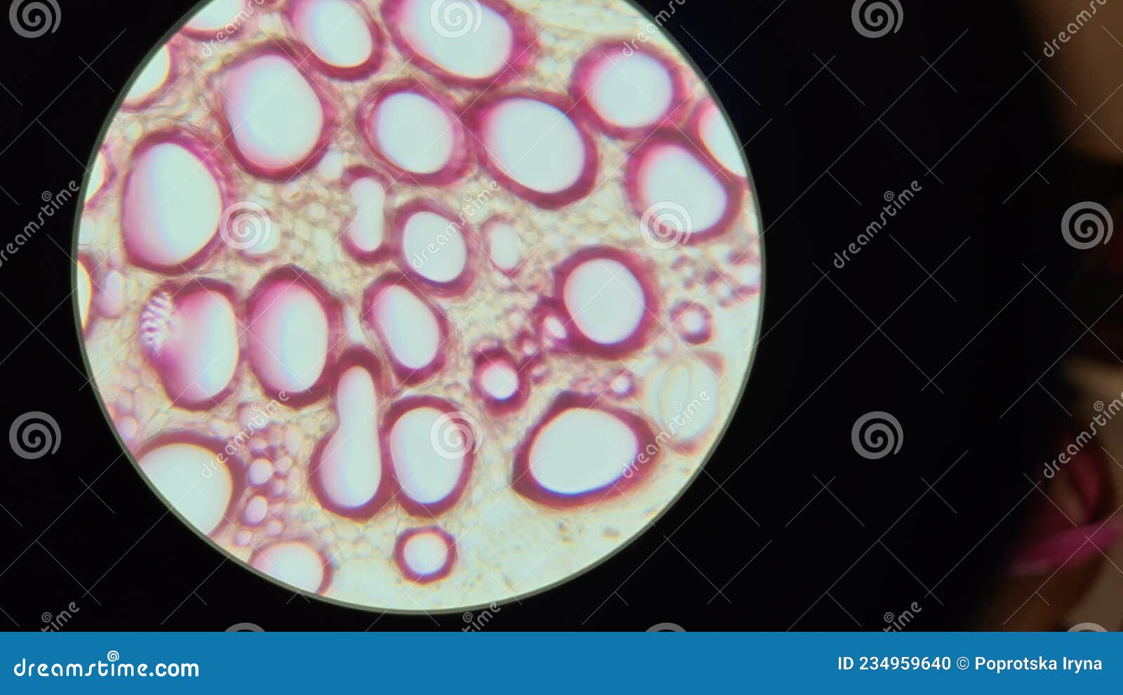 Microscopic Photo of Xylem in Beet Root Permanent Preparation Stock ...