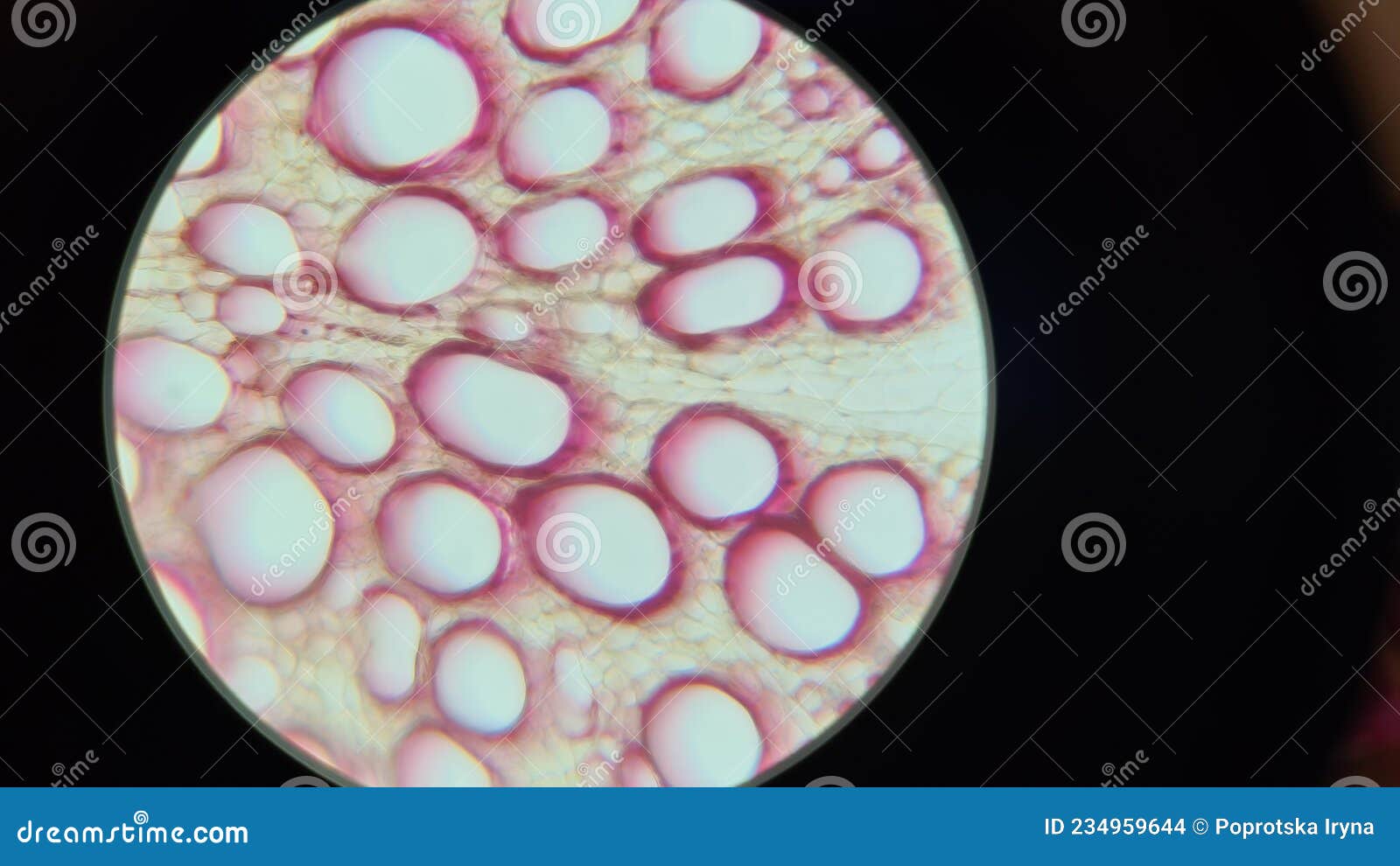 Microscopic Photo of Xylem in Beet Root Permanent Preparation Stock ...