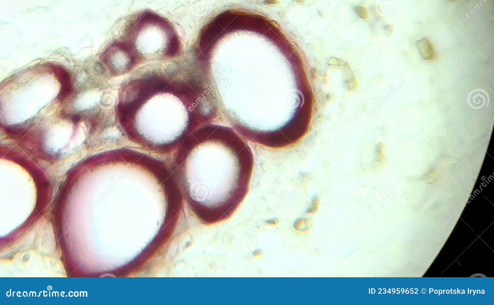 Microscopic Photo of Xylem in Beet Root Permanent Preparation Stock ...