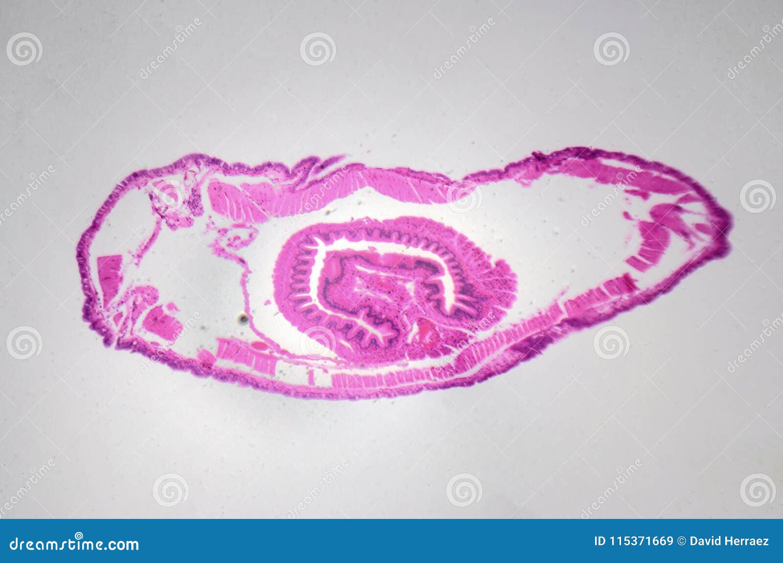 Earthworm Microscope