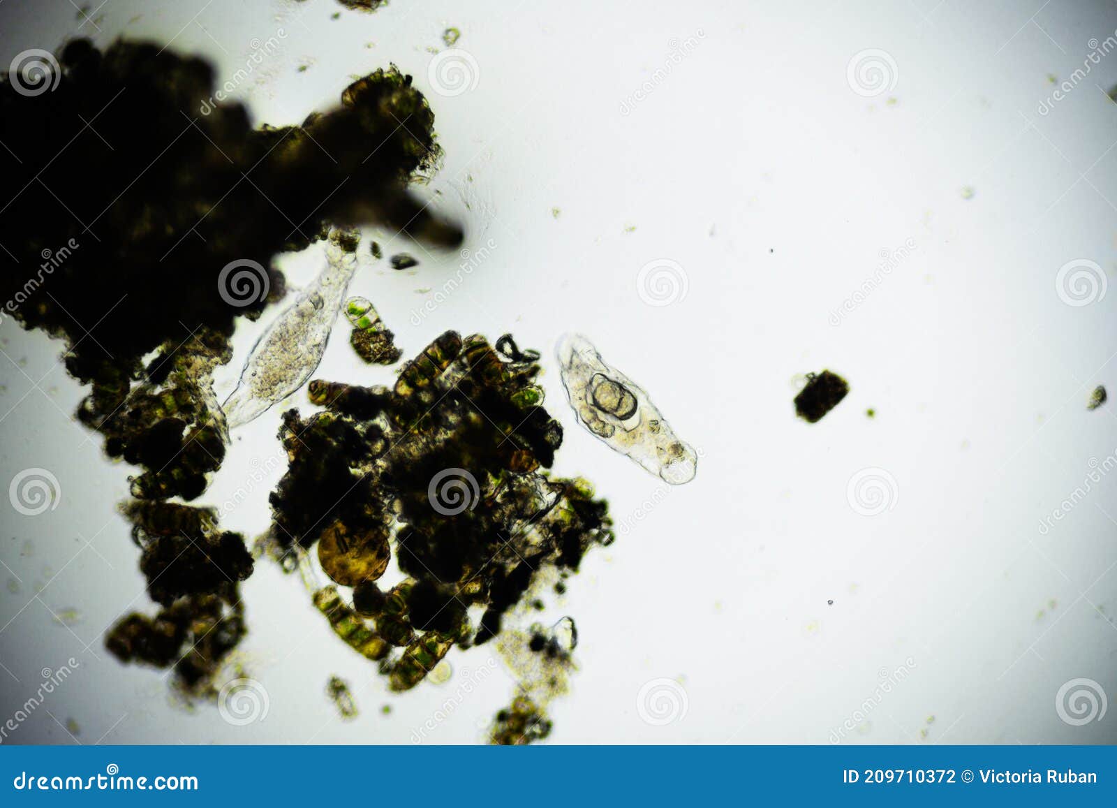 Microscopic Rotifer or Rotifera Under a Microscope Stock Photo - Image ...