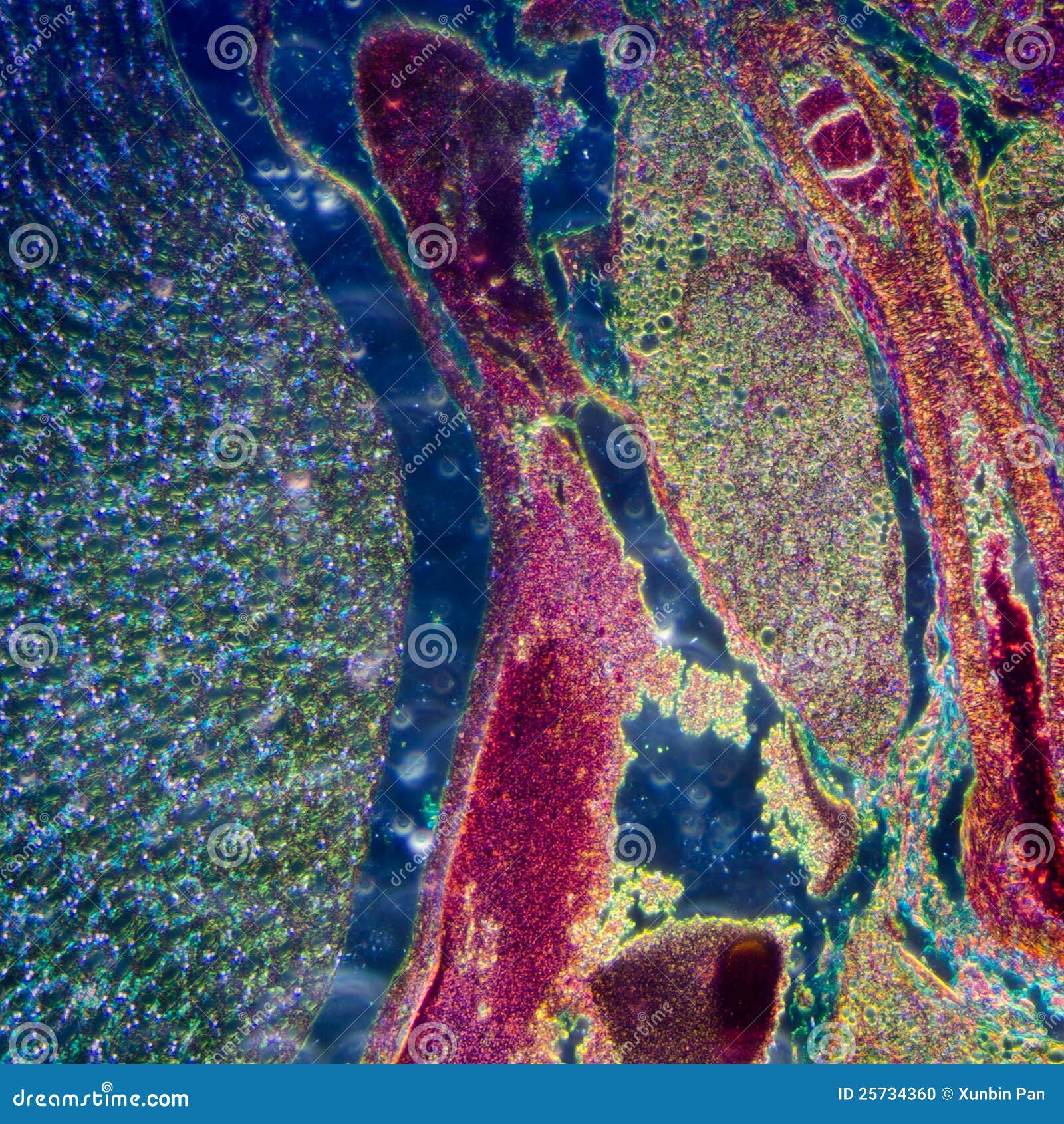 Microscopic Section of Human Kidney Stock Photo - Image of healthy ...