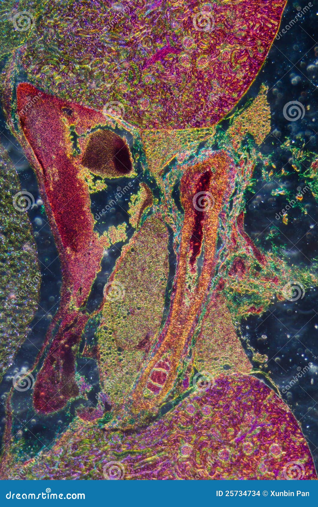Microscopic Section of Human Kidney Stock Photo - Image of green, cells ...