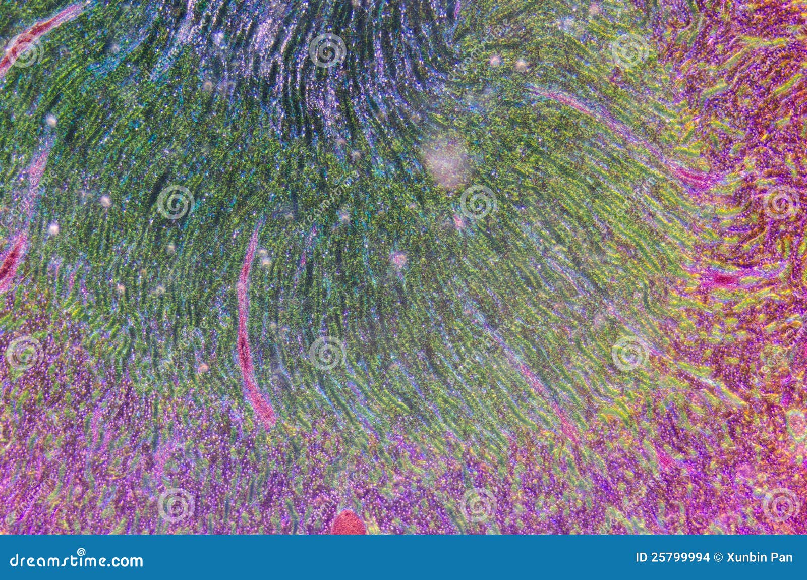 Microscopic Section of Human Kidney Stock Photo - Image of photograph ...