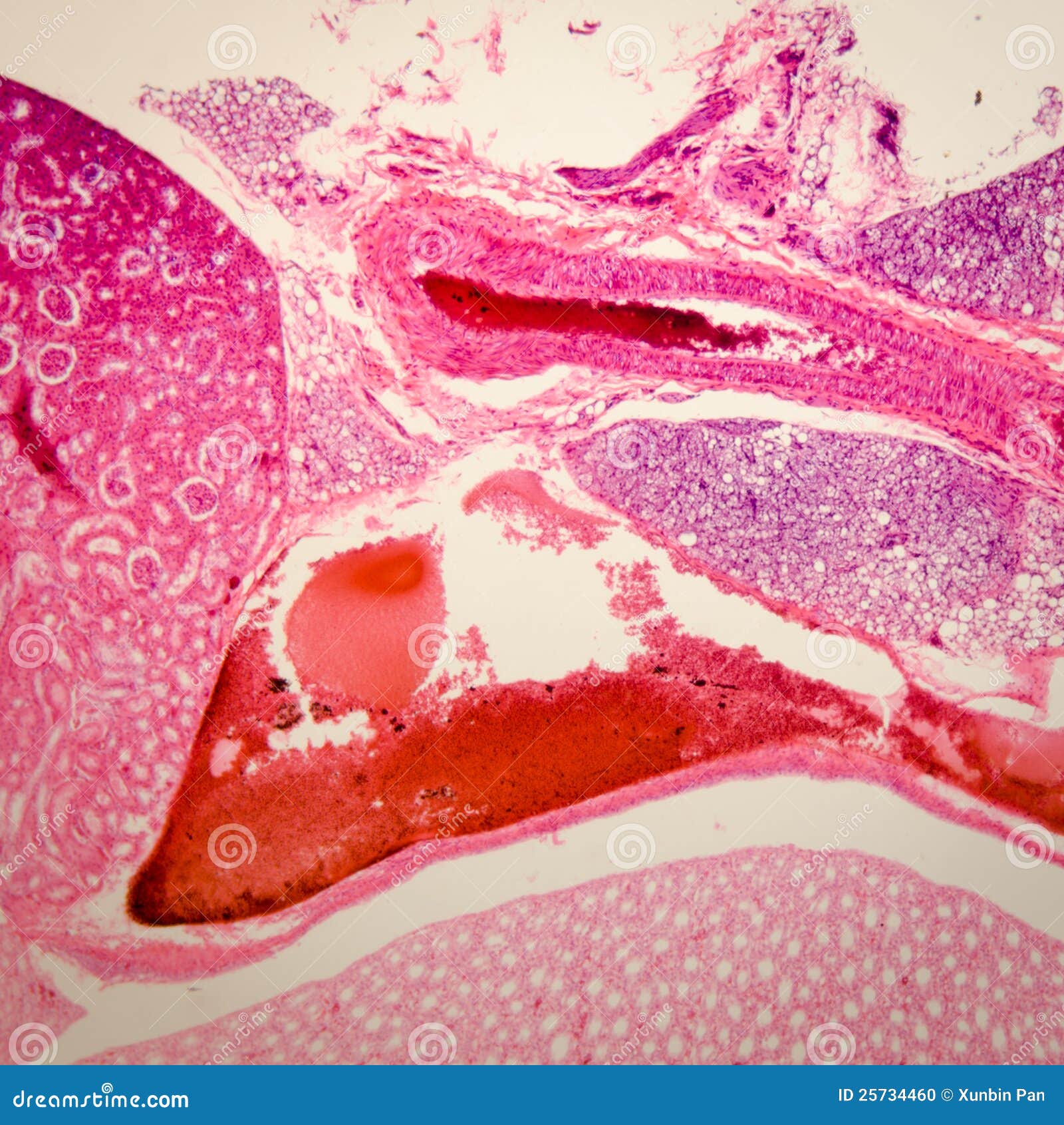 Microscopic Section O Kidney Stock Photo - Image of cross, medical ...