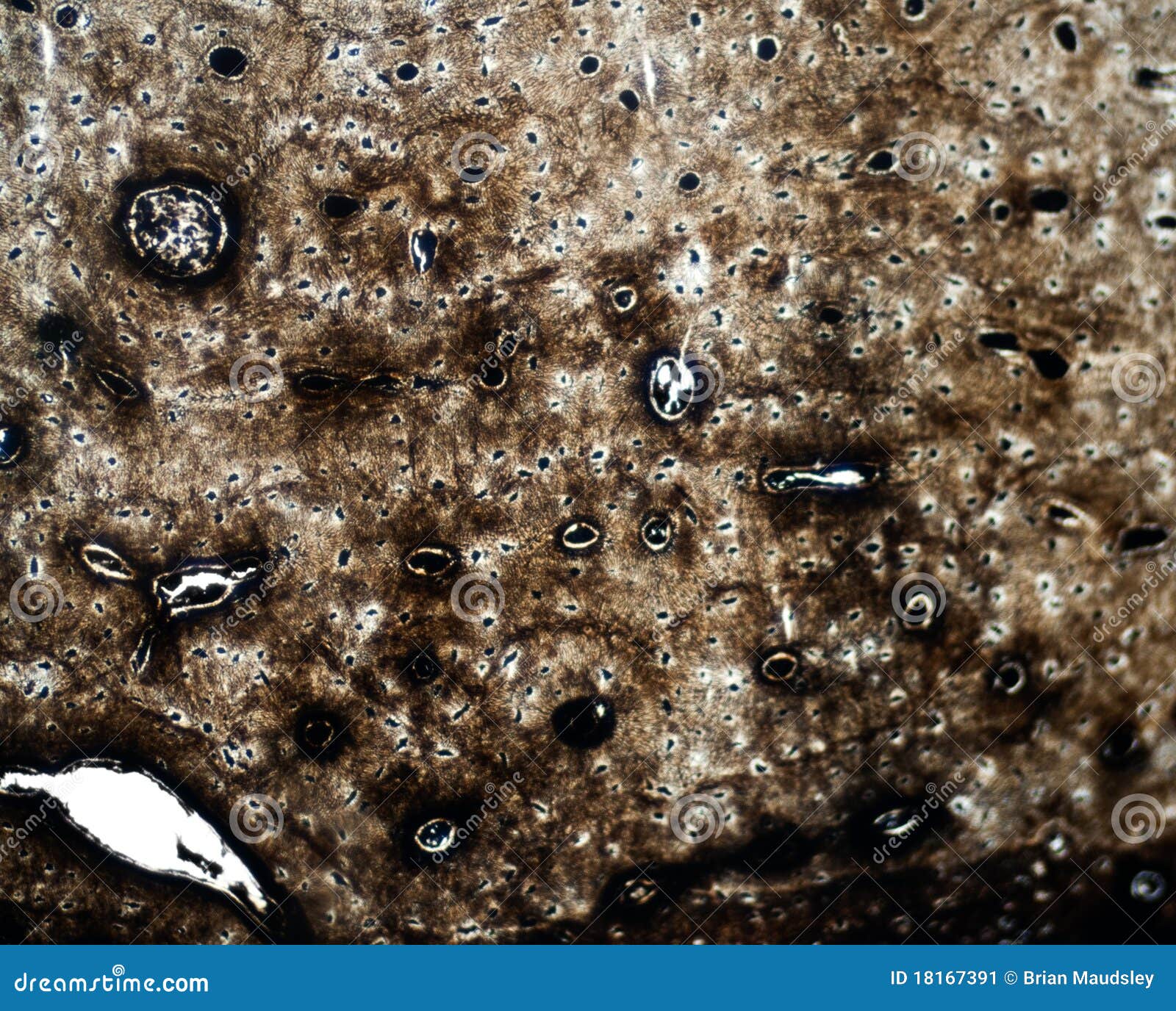 Microscopic Section X100 of Compact Bone. Stock Image - Image of ...