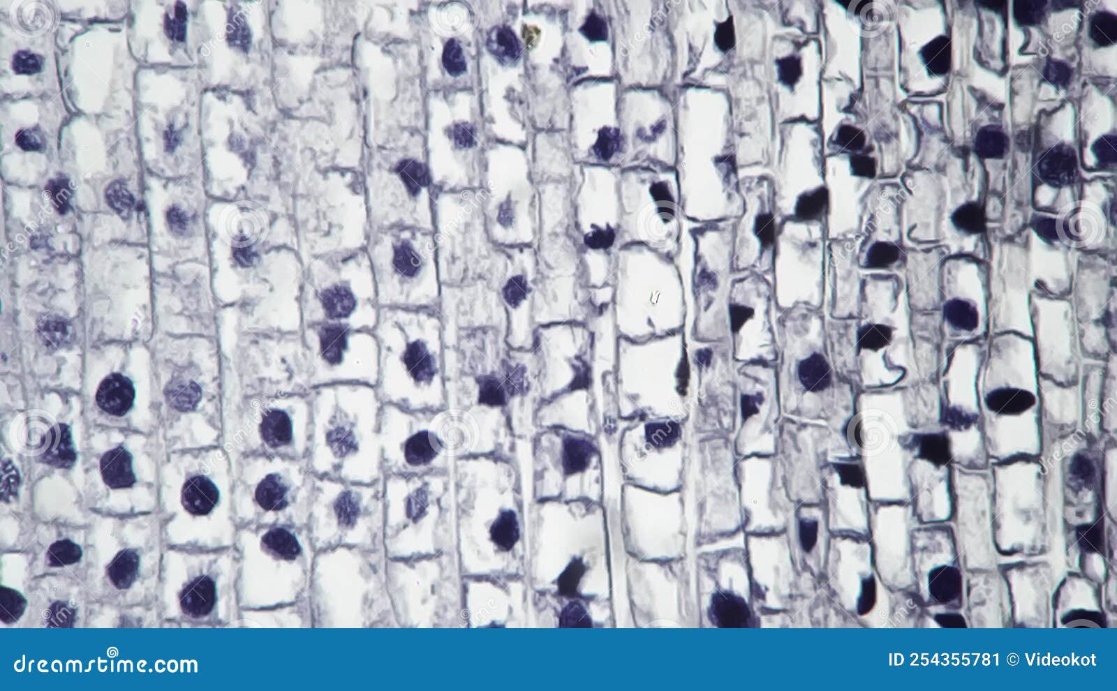 Microscopic Slide of Allium Cepa Root Tip in Longitudinal Section 400x ...